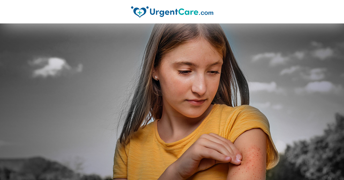 Skin Rash is Covered by Telemedicine